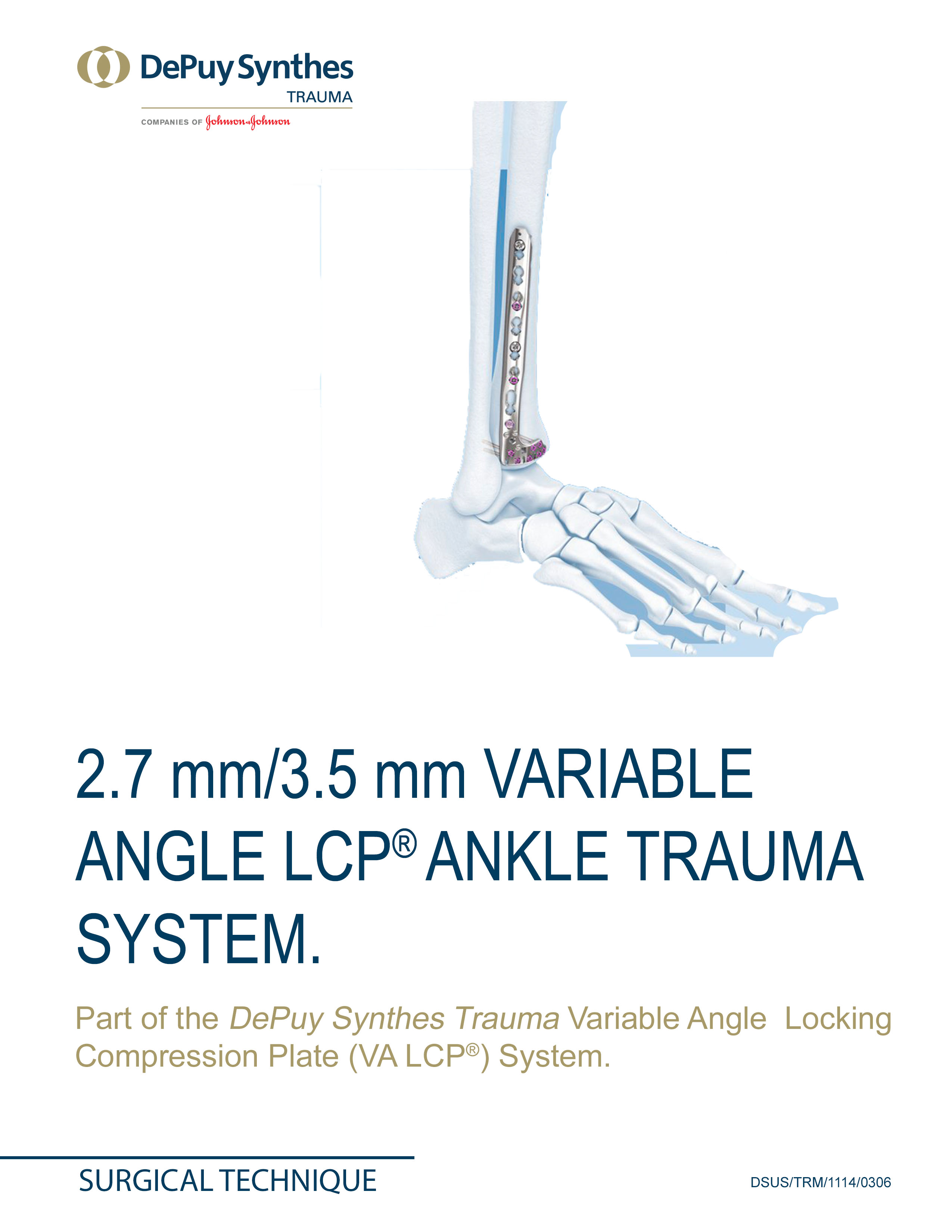 DePuy Synthes, Stryker Leads Europe Market for Orthopedic Trauma ...