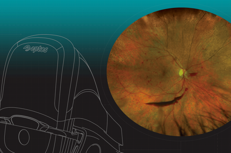 Ophthalmic Devices Market News - iData Research