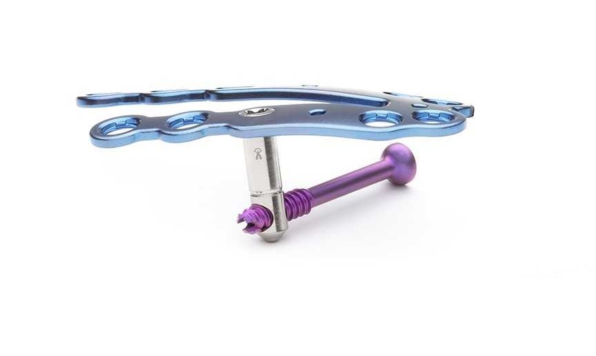 Extremity Medical Announces the Release of the Omni Plating System ...
