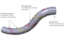 BIOTRONIK Wins FDA Approval for Orsiro Coronary Stent - iData Research