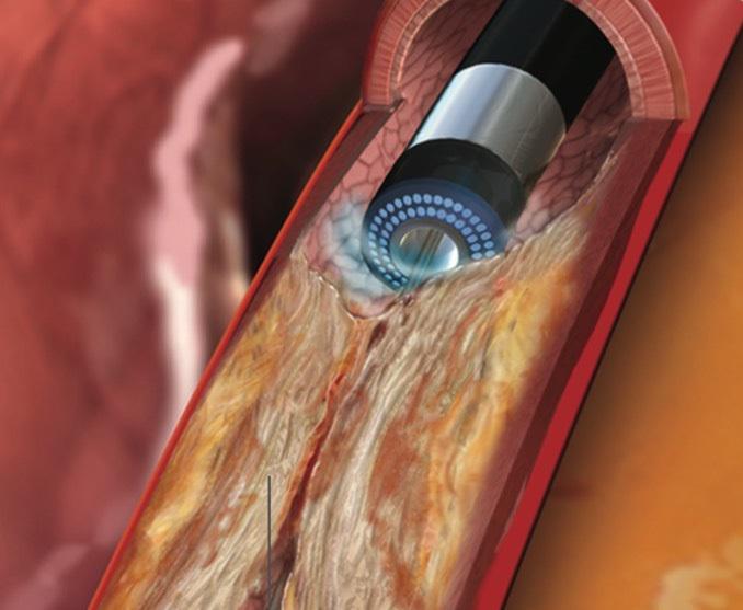 Articles Market News - iData Research